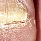 The home of Irish Dancing - Antonio Pacelli